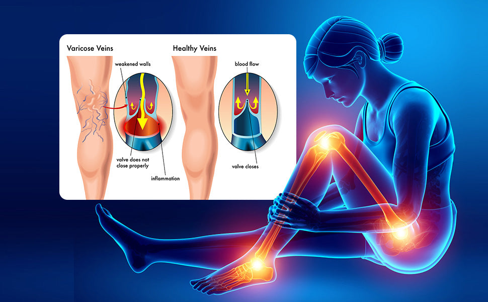 Chaussettes De Compression - Open Toe – Miso Maroc